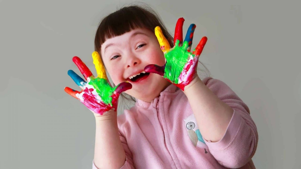 Si të motivojmë fëmijët me Sindromën Down? 10 orientime praktike për ...